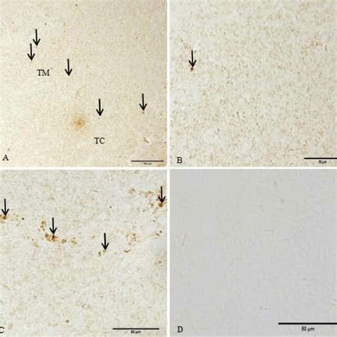 Photomicrographs Of Ghrelin Immunopositive Ghrelin Ip Cells In The