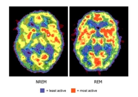 In Rem Sleep Brain