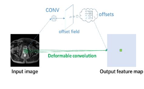 Schematic Diagram Of The Deformation Convolution Operation On The Download Scientific Diagram