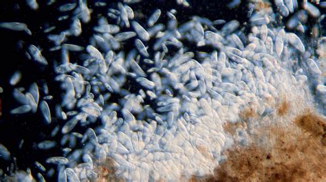 High Density Of Unicellular Paramecium Protozoa Under Microscope Free