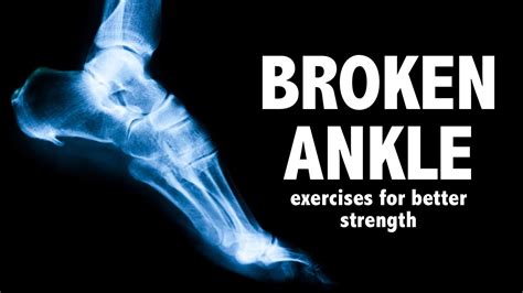 Broken Ankle Exercises To Improve Strength Level 1 Beginner Youtube
