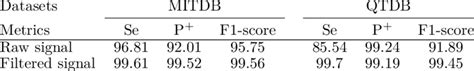 Qrs Detection Performance Of The Proposed Dens Ecg Model For The Mitdb