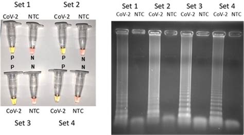 Colorimetric Rt Lamp Reaction For Sars Cov 2 2400 Copies Using Four Download Scientific