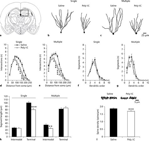 Dendritic Structures Of The Dg Granule Cells A The Dorsal Hippocampus