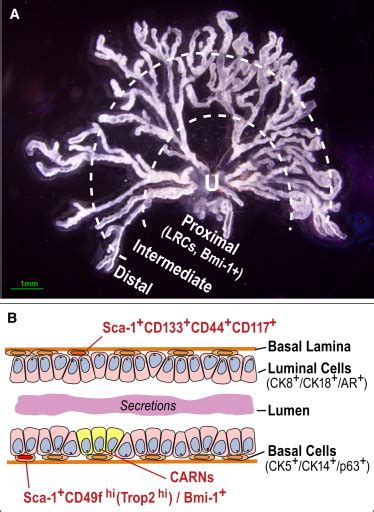 An Old Player On A New Playground Bmi 1 As A Regulator Of Prostate