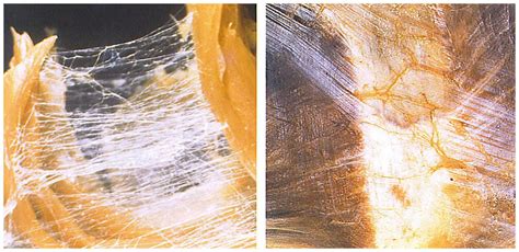 Fascia And Posture Understanding Its Significance