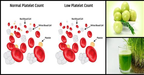 Increase Your Platelet Count The Natural Way Dr Farrah MD