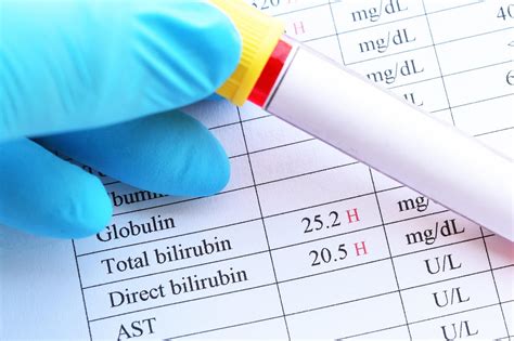 Asthma Risk In Infants Predicted By Total Serum Bilirubin Pulmonology Advisor