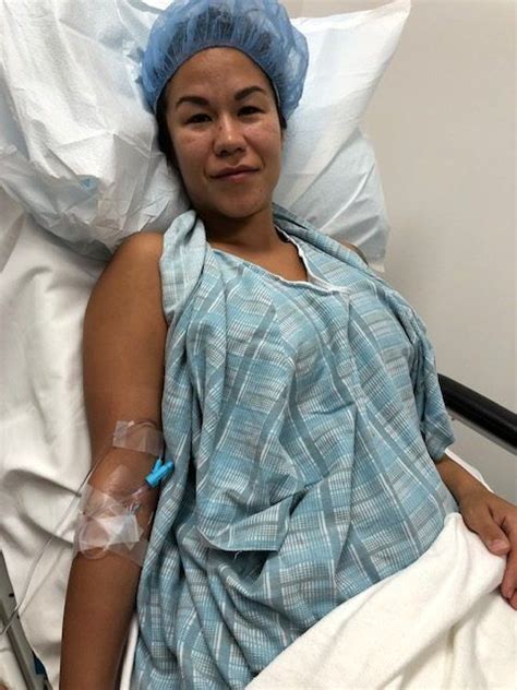 Why I Removed My Breast Implants One Week Post Explant Breast Implant