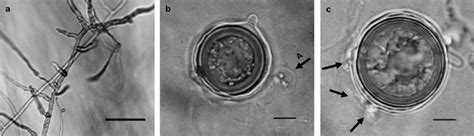 Morphological Structures Of Pythium Longipapillum A Strictly