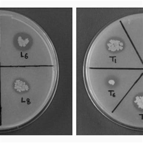 Solubilization Of Inorganic Tri Calcium Phosphate In Vitro By Bacterial