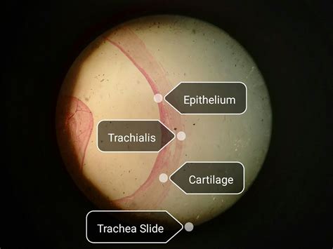 Medical Stuff Histology Slides Of Respiratory Track
