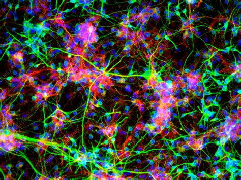 Neural Stem Cells Light Micrograph Stock Image C025 3223 Artofit
