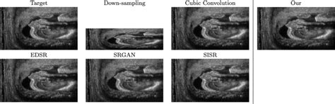 Comparison Of Up Sampling Methods Vs Our Method On The Obstetric