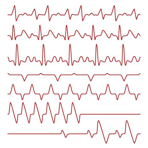 Cardiogramme En Ligne Ou électrocardiogramme Sur Moniteur Vecteur Premium