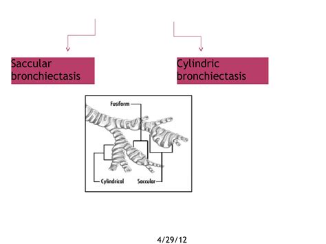 Bronchiectasis And Their Causes Symptoms Pdf Lung And Respiratory Health Diseases And