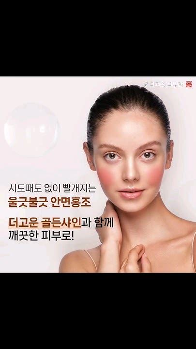 시도때도 없이 빨개지는 안면홍조 더고운에서 해결해보세요 ~ Shorts Youtube