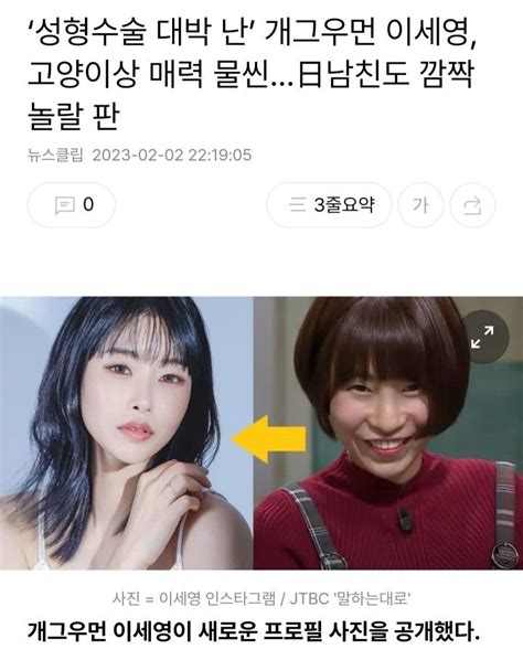 성형수술 대박 난 개그우먼 이세영 고양이상 매력 물씬日남친도 깜짝 놀랄 판