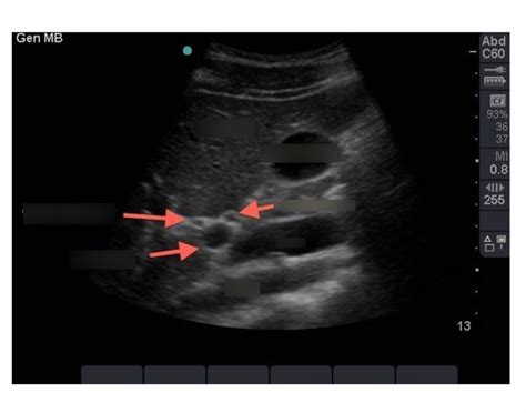 Med Imaging GI US Diagram Quizlet