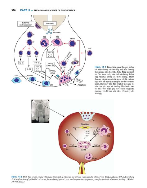 Chương 14 Pathway Bệnh Lý Cận Chópab