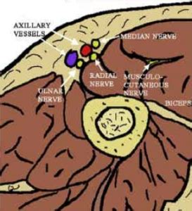 Axillary Block Dr Peter Hebbard