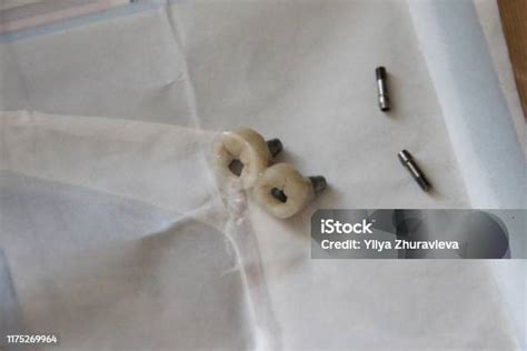 치과 임플란트 멸균 의료 용 봉투 치과 용 이중 치과 용 크라운 및 장착용 나사 한 쌍 건강관리와 의술에 대한 스톡 사진 및 기타 이미지 건강관리와 의술 관교의치