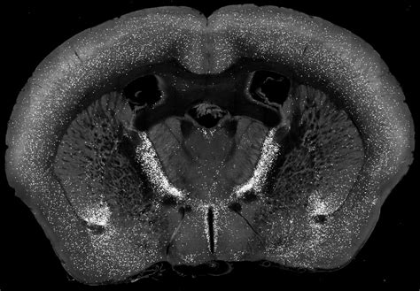 Cell Type Landing Brain Architecture Project