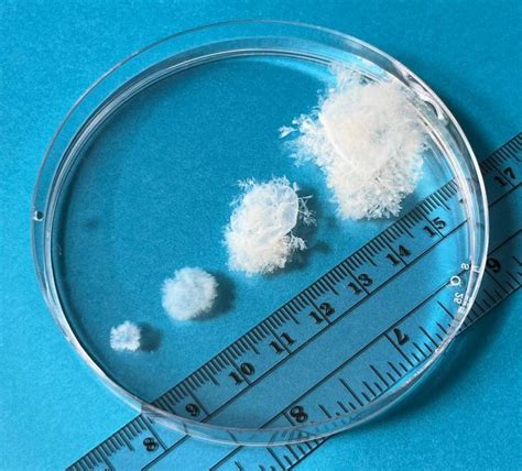 Photos Show Pregnancy Tissue Before 10 Weeks