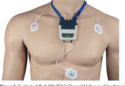 Figure 1 From End To End Premature Ventricular Contraction Detection Using Deep Neural Networks