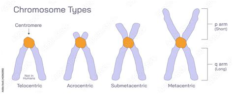 Tyeps Of Chromosome Acrocentric Telocentric Submetacentric