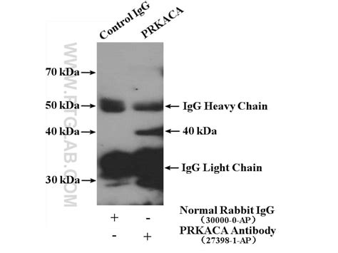 Prkaca Antibody 27398 1 Ap