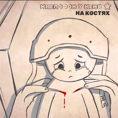 Миелофон у меня На костях Bandlink