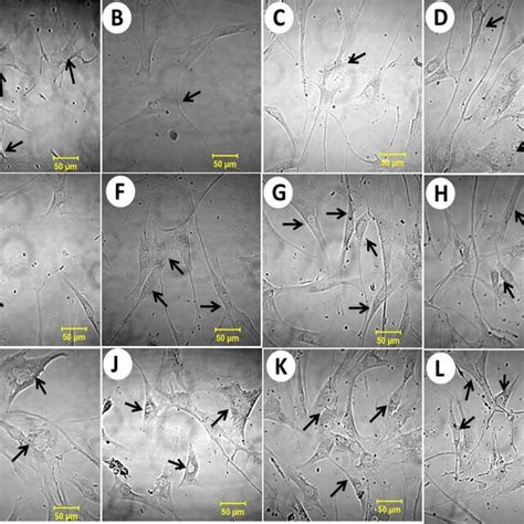 Cell Count Image Of Fibroblast On Glass Plate Irradiated With 90 Fs Download Scientific Diagram