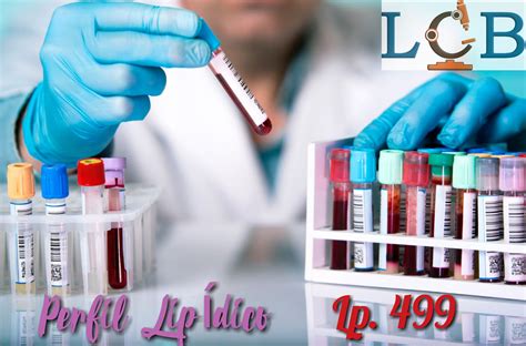 Qué Es El Perfil Laboratorio Clínico De Bioanálisis