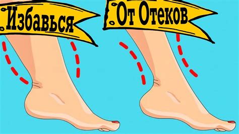 Как навсегда избавиться от ОТЁКОВ Youtube