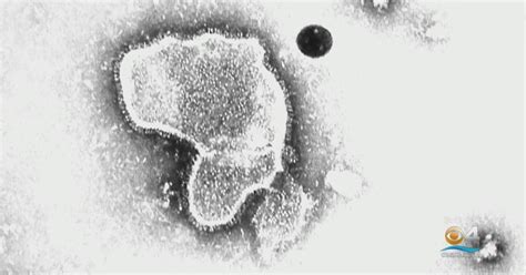 RSV Cases Causing Highest Flu Rates In Over A Decade CBS Miami