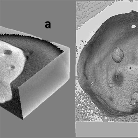 A 3d Micro Ct Image Of The Composite Restoration Before Image Download Scientific Diagram