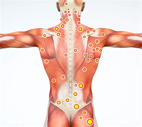 Shoulder Trigger Points And Ims An Effective Therapy Youve Likely