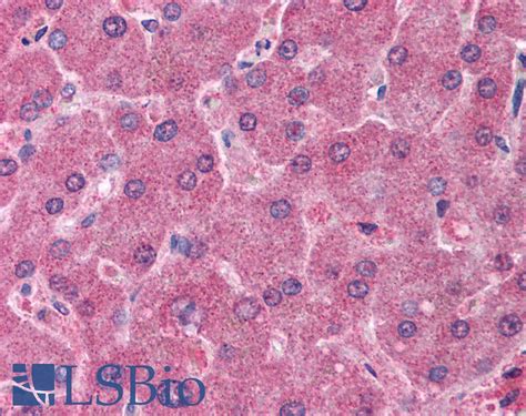 Ihc Plus™ Cd71 Transferrin Receptor Polyclonal Antibody Rabbit Lsbio