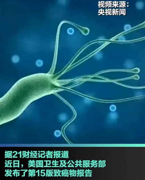 美国将幽门螺旋杆菌列为明确致癌物！咋预防？财经头条