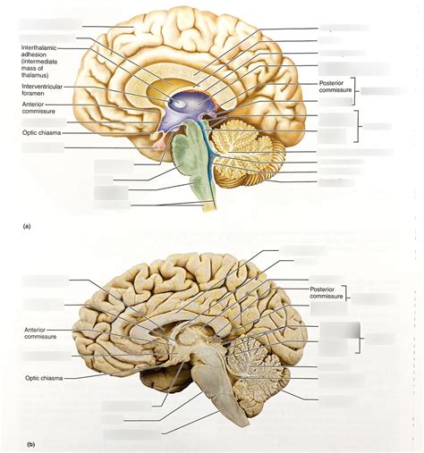 Median Section Of Human Brain Diagram Quizlet