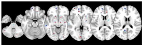 New Preprint On Brain Differences As A Function Of Gender Identity Or Sexual Orientation A