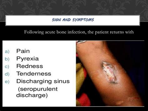 Ppt Chronic Osteomyelitis Powerpoint Presentation Free Download Id