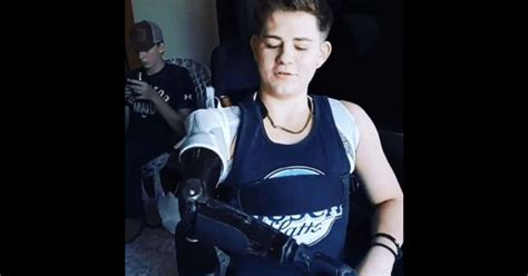Loren Schauers Man Cut In Half By Forklift Wanted To Be Saved Even If