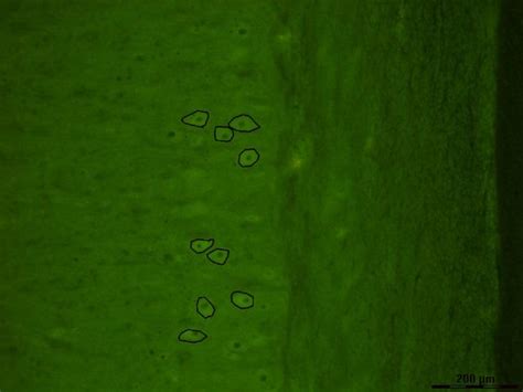 Laser Microdissection Extract Specific Regions From Your Sample Euro