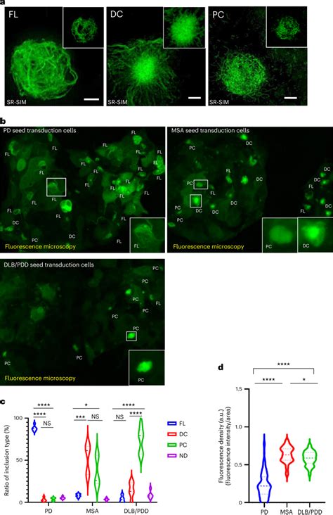 Serum Iprt Quic Amplified α Synuclein Seeds From Participants With Pd