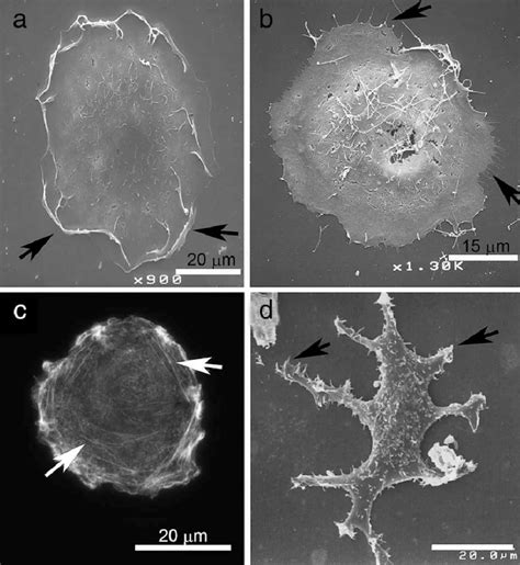 Fig Ure 2 Typical Appearance Of The Actin Architectures Referred To In