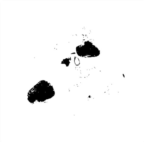Github Ckorgiallung Tumor Detection Lung Tumor Detection On Single