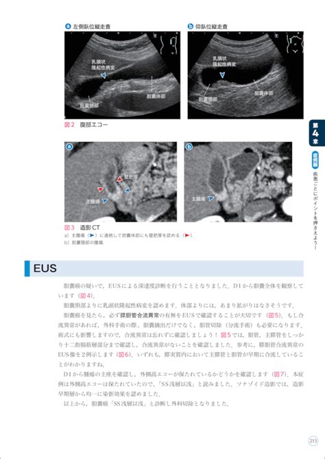 胆膵eusセミナー〜ct・シェーマ・動画と合わせてわかる手技の基本から治療まで 羊土社