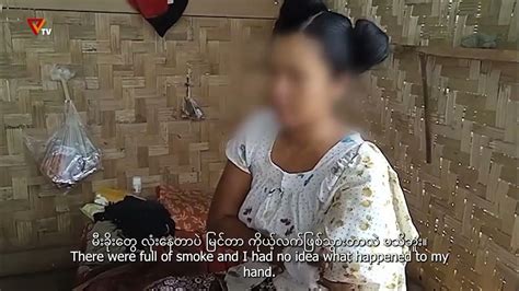 ပဇီကြီးကျေးရွာတိုက်ခိုက်ခံရမှုဖြစ်စဉ်မှာ လက်တစ်ဖက်ဆုံးရှုံးလိုက်ရတဲ့